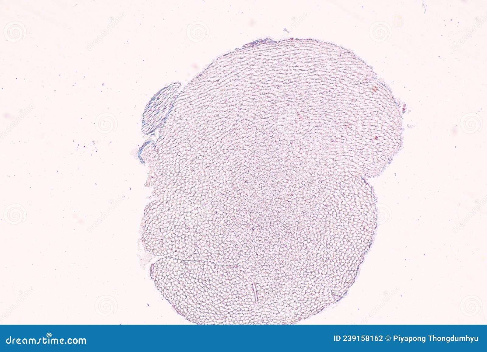 Motor Neuron and Nerve Cells Under the Microscope. Stock Photo - Image ...