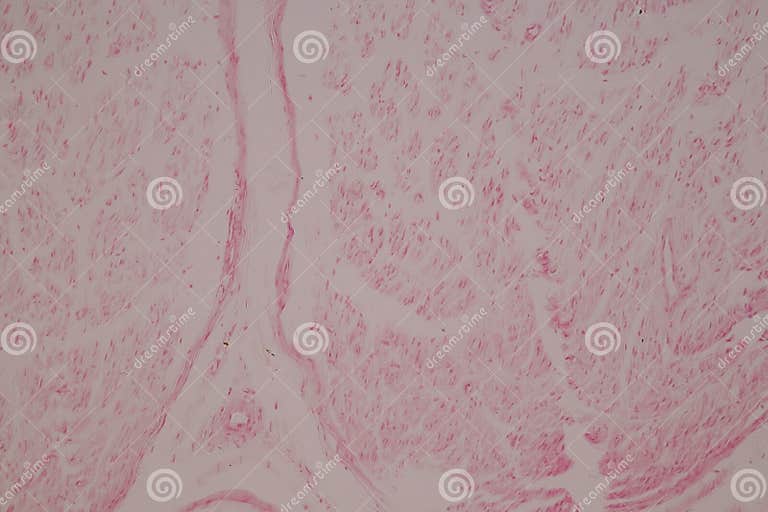 Motor Neuron and Nerve Cells Under the Microscope. Stock Image - Image ...