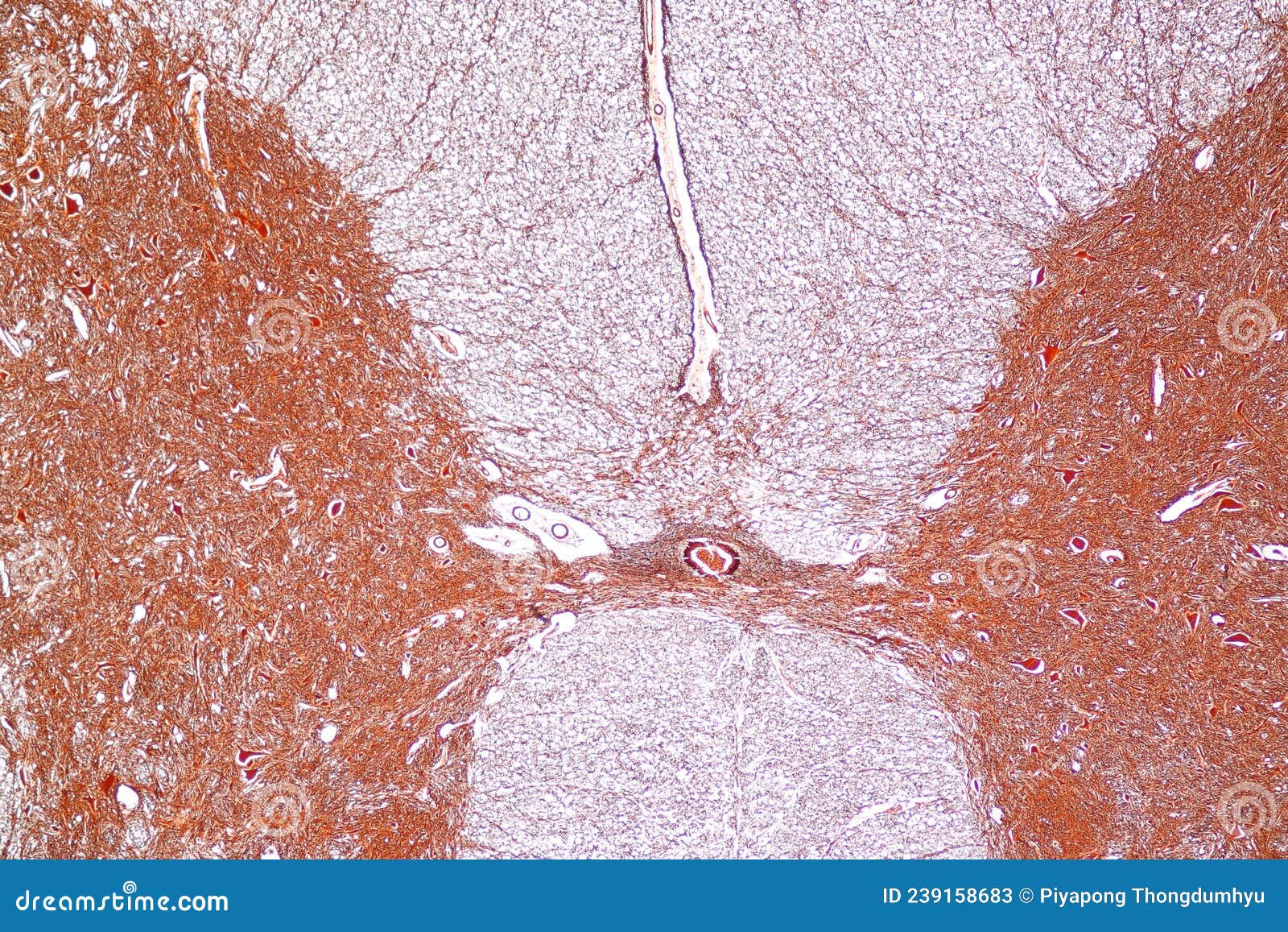 Motor Neuron and Nerve Cells Under the Microscope. Stock Image - Image ...