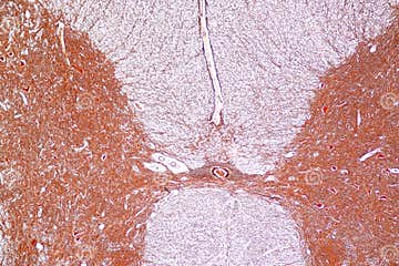 Motor Neuron and Nerve Cells Under the Microscope. Stock Image - Image ...