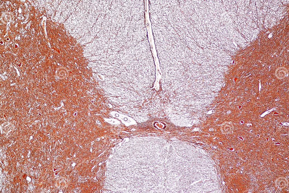 Motor Neuron and Nerve Cells Under the Microscope. Stock Image - Image ...