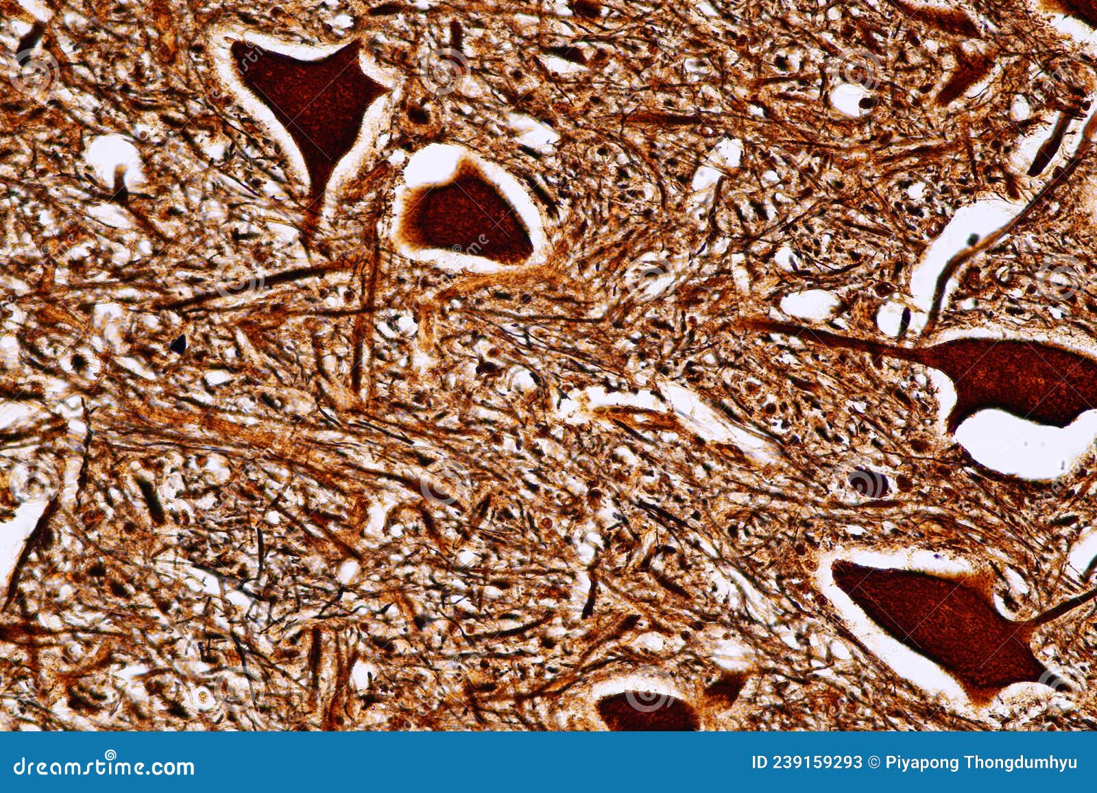 Motor Neuron And Nerve Cells Under The Microscope. Stock Image ...