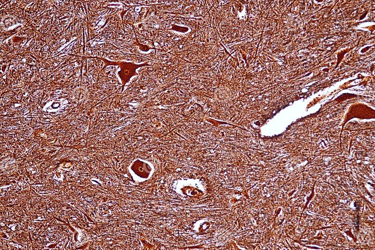 Motor Neuron and Nerve Cells Under the Microscope. Stock Photo - Image ...