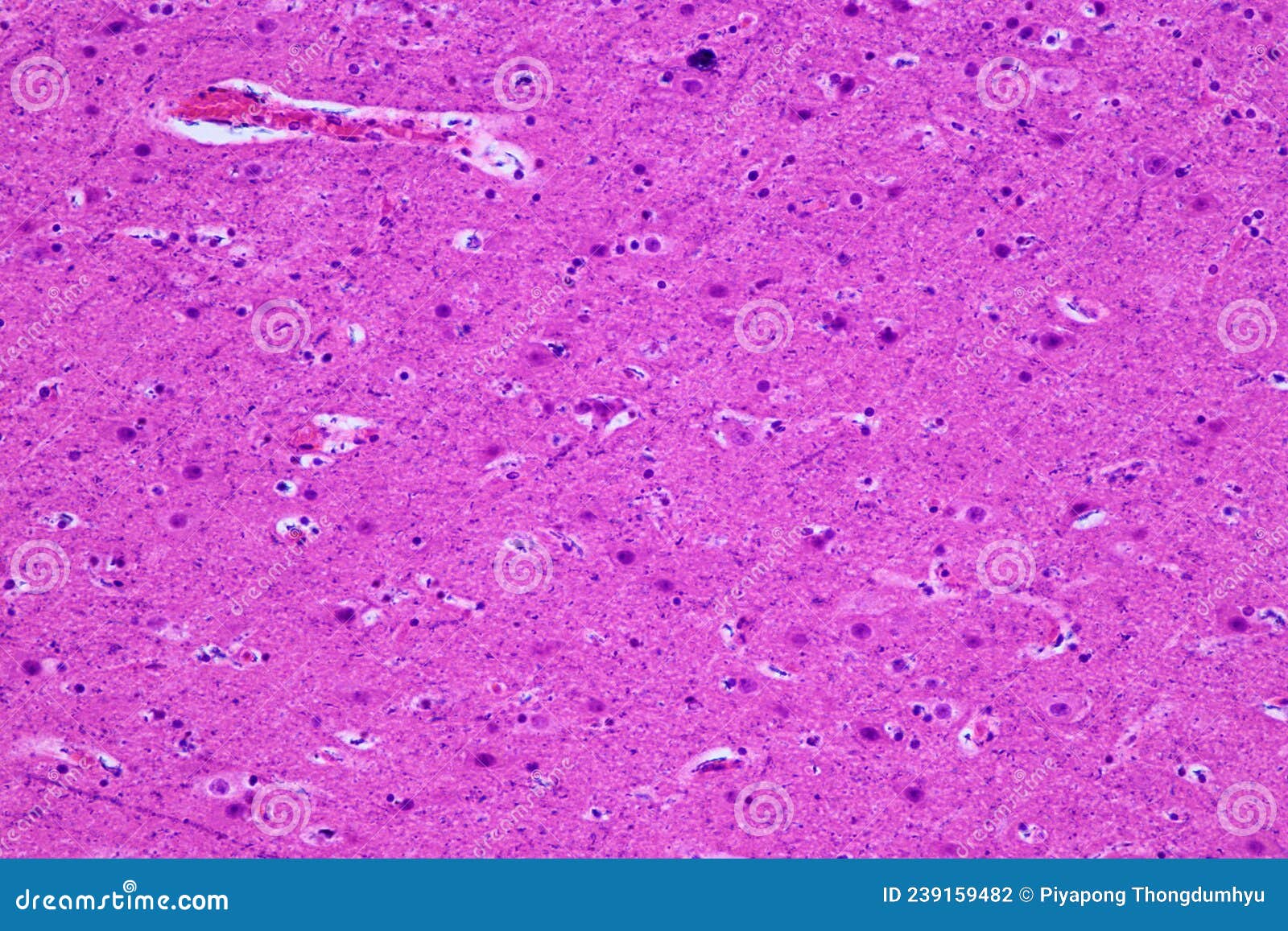Motor Neuron and Nerve Cells Under the Microscope. Stock Photo - Image ...