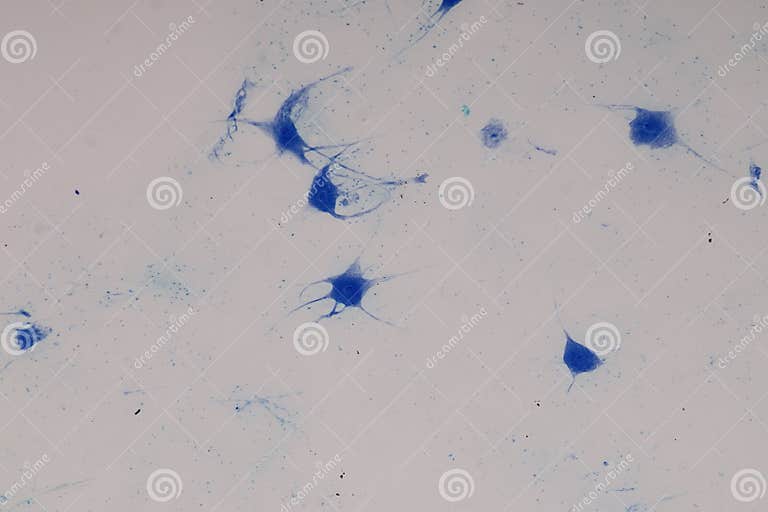 Motor Neuron and Nerve Cells Under the Microscope. Stock Image - Image ...