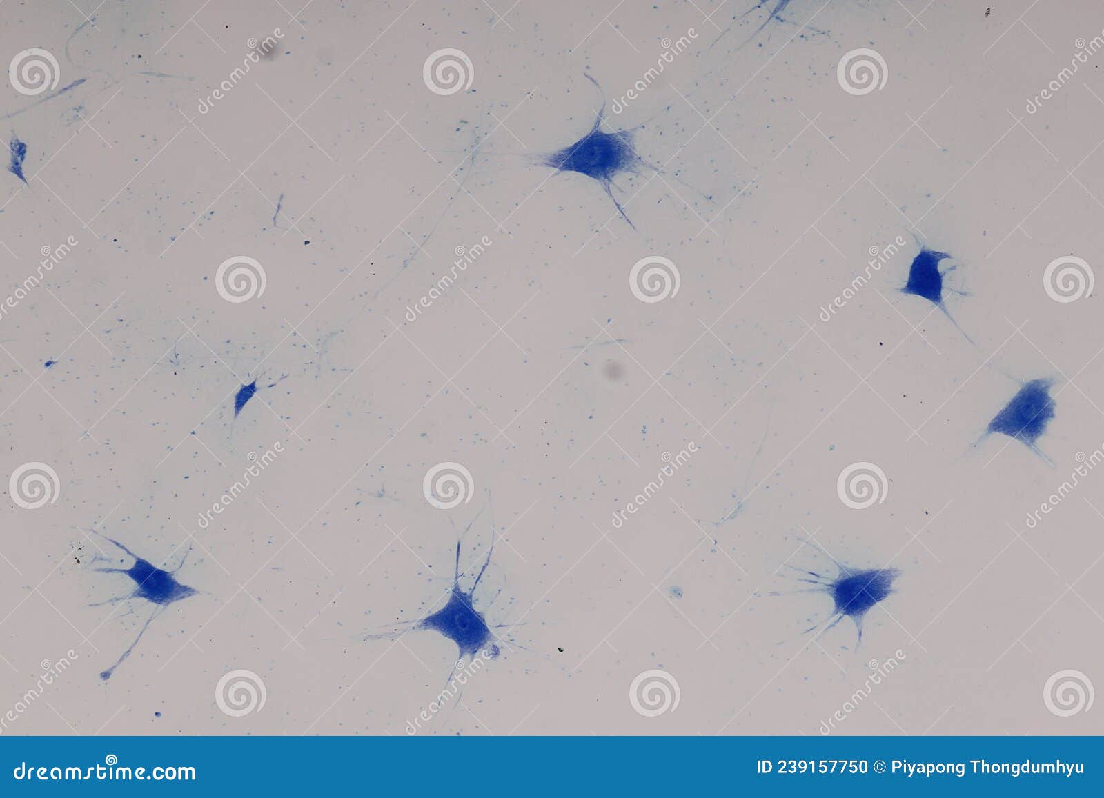 Motor Neuron and Nerve Cells Under the Microscope. Stock Photo - Image ...