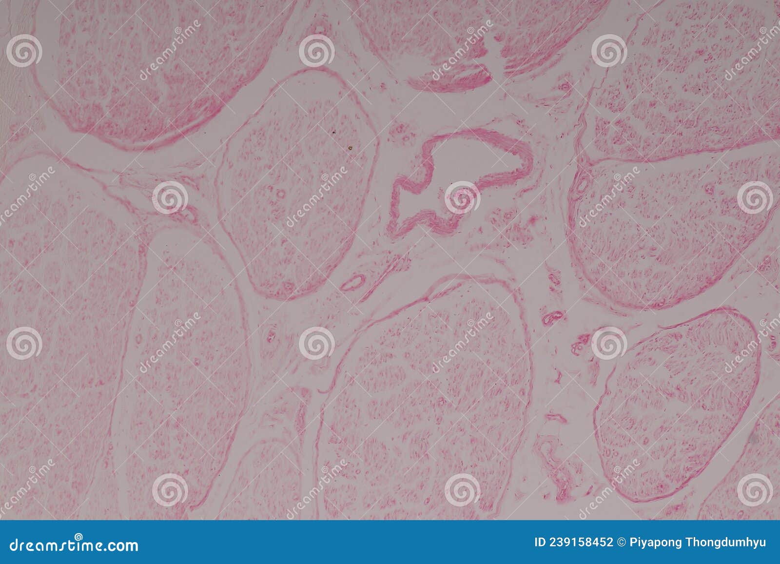 Motor Neuron and Nerve Cells Under the Microscope. Stock Photo - Image ...