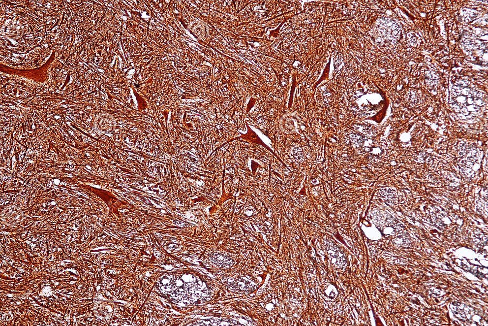 Motor Neuron and Nerve Cells Under the Microscope. Stock Image - Image ...