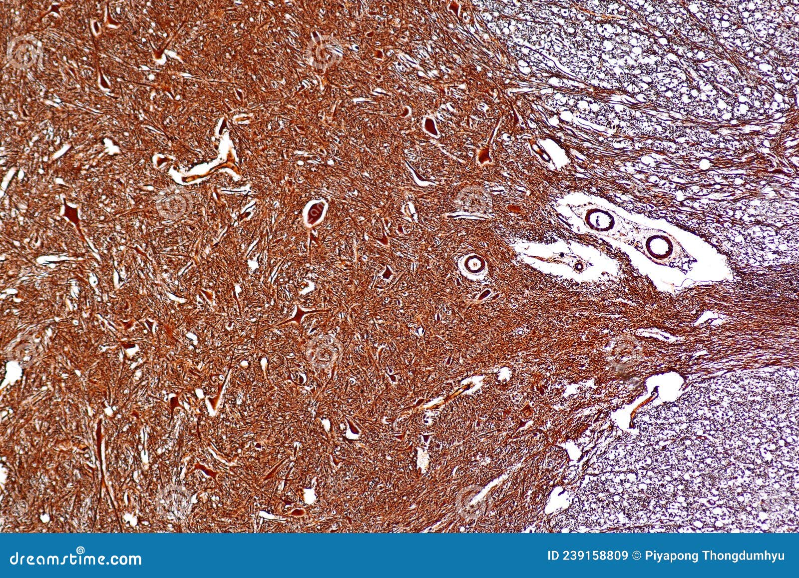Motor Neuron and Nerve Cells Under the Microscope. Stock Image - Image ...