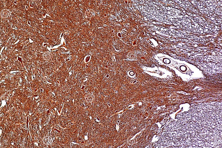 Motor Neuron and Nerve Cells Under the Microscope. Stock Image - Image ...