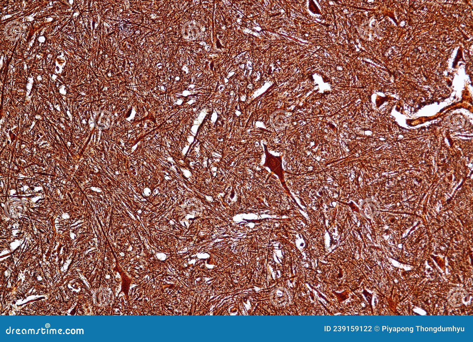 Motor Neuron and Nerve Cells Under the Microscope. Stock Photo - Image ...