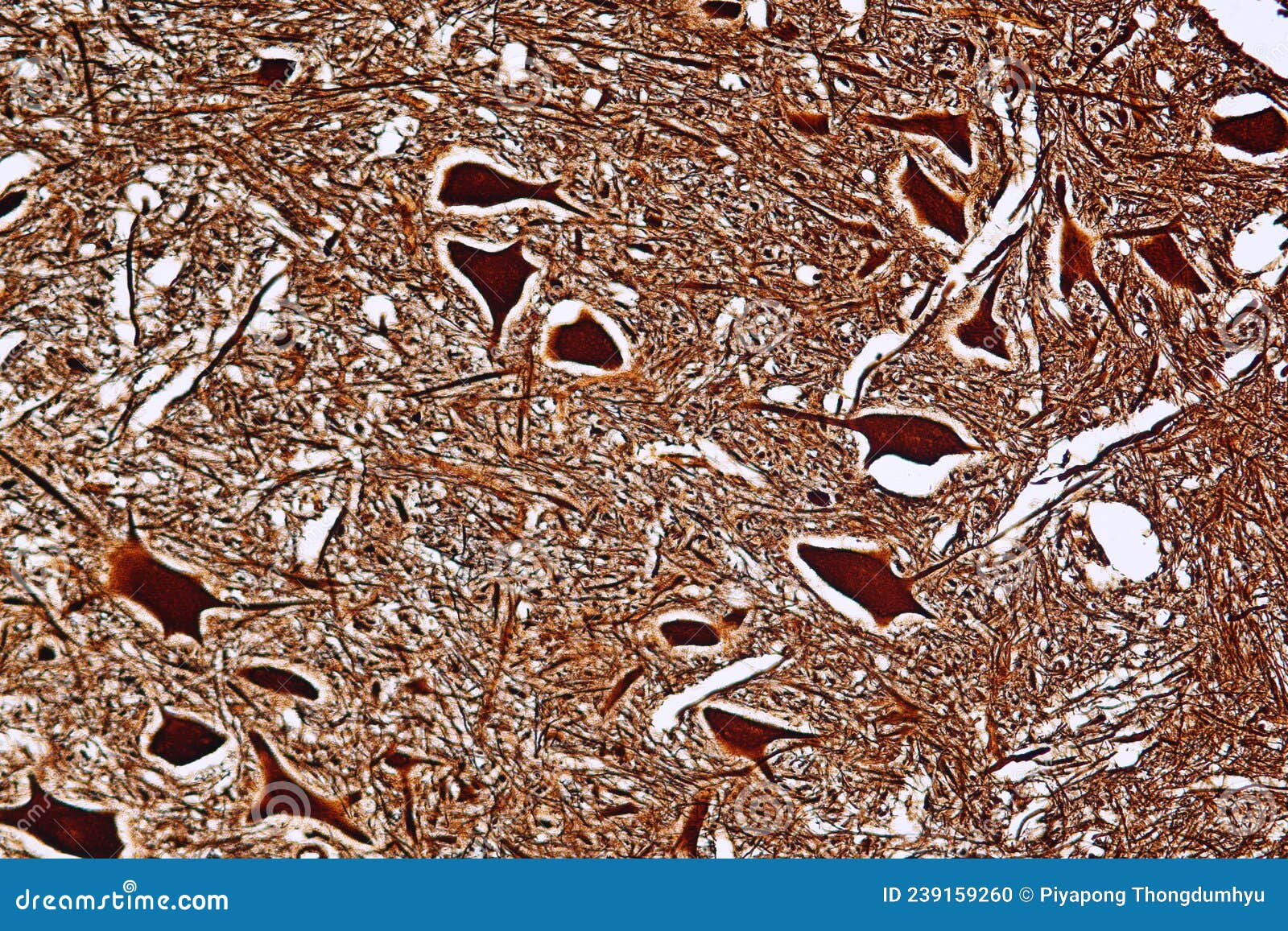 Motor Neuron and Nerve Cells Under the Microscope. Stock Photo - Image ...