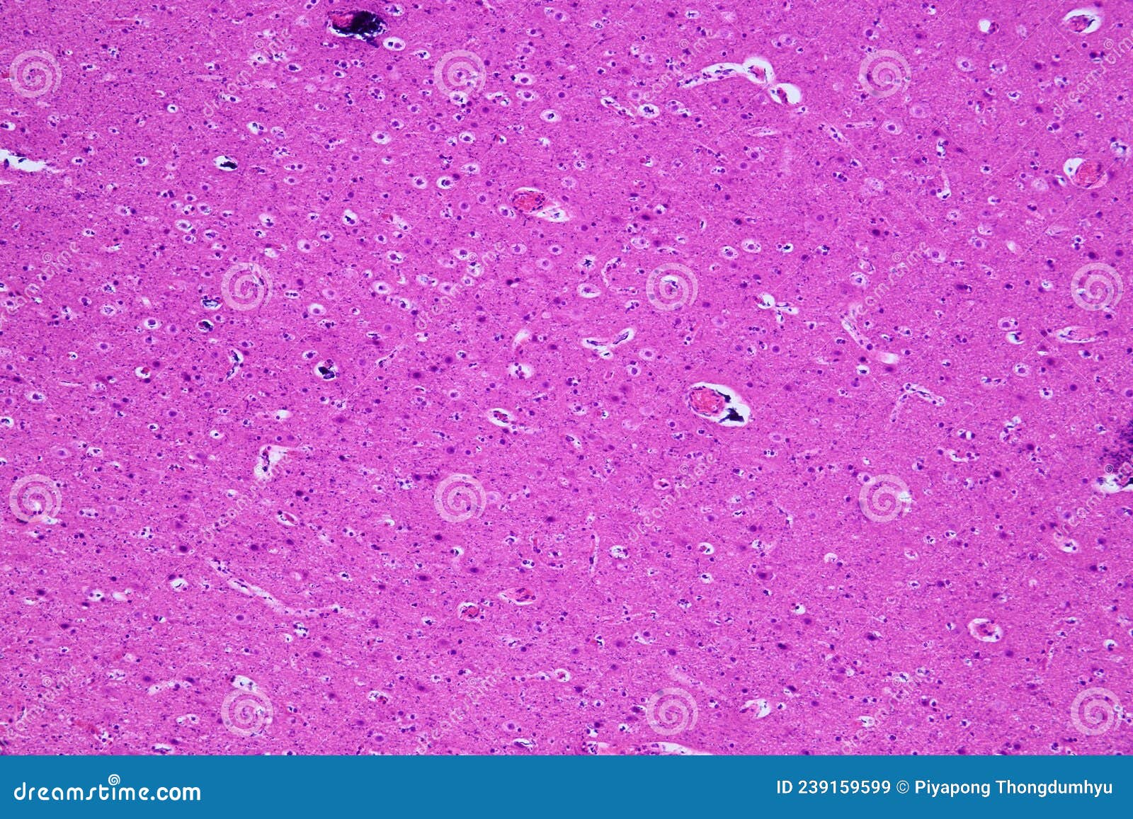 Motor Neuron and Nerve Cells Under the Microscope. Stock Image - Image ...