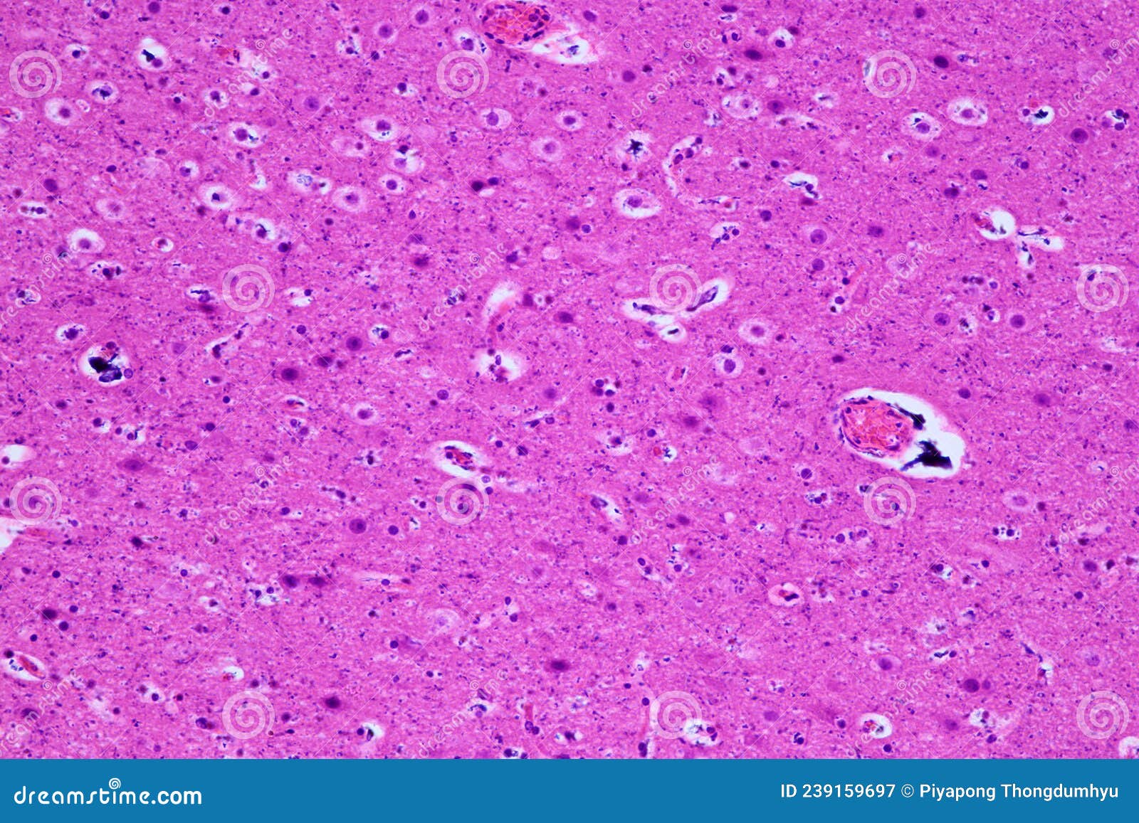 Motor Neuron and Nerve Cells Under the Microscope. Stock Image - Image ...