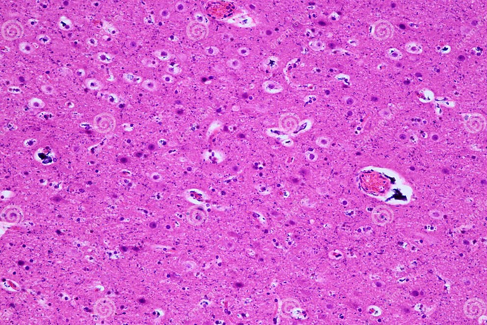 Motor Neuron and Nerve Cells Under the Microscope. Stock Image - Image ...