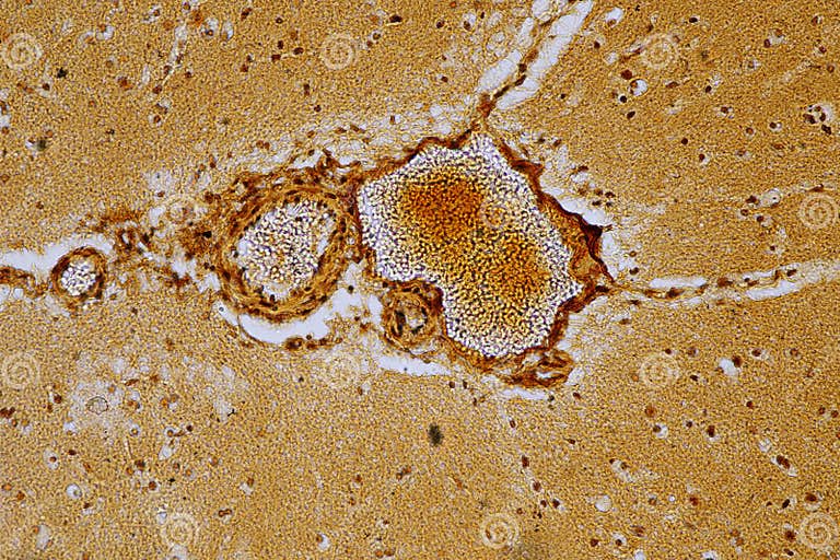 Motor Neuron and Nerve Cells Under the Microscope. Stock Image - Image ...