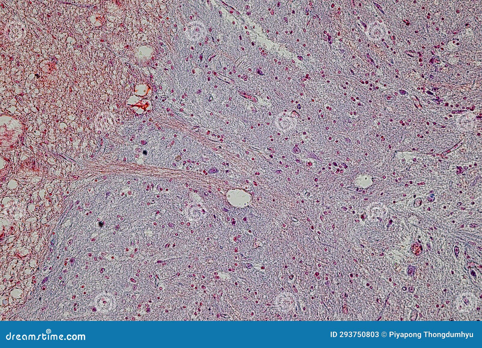 Motor Neuron, Spinal Cord, Nerve Fibres and Nerve Cells Under the ...