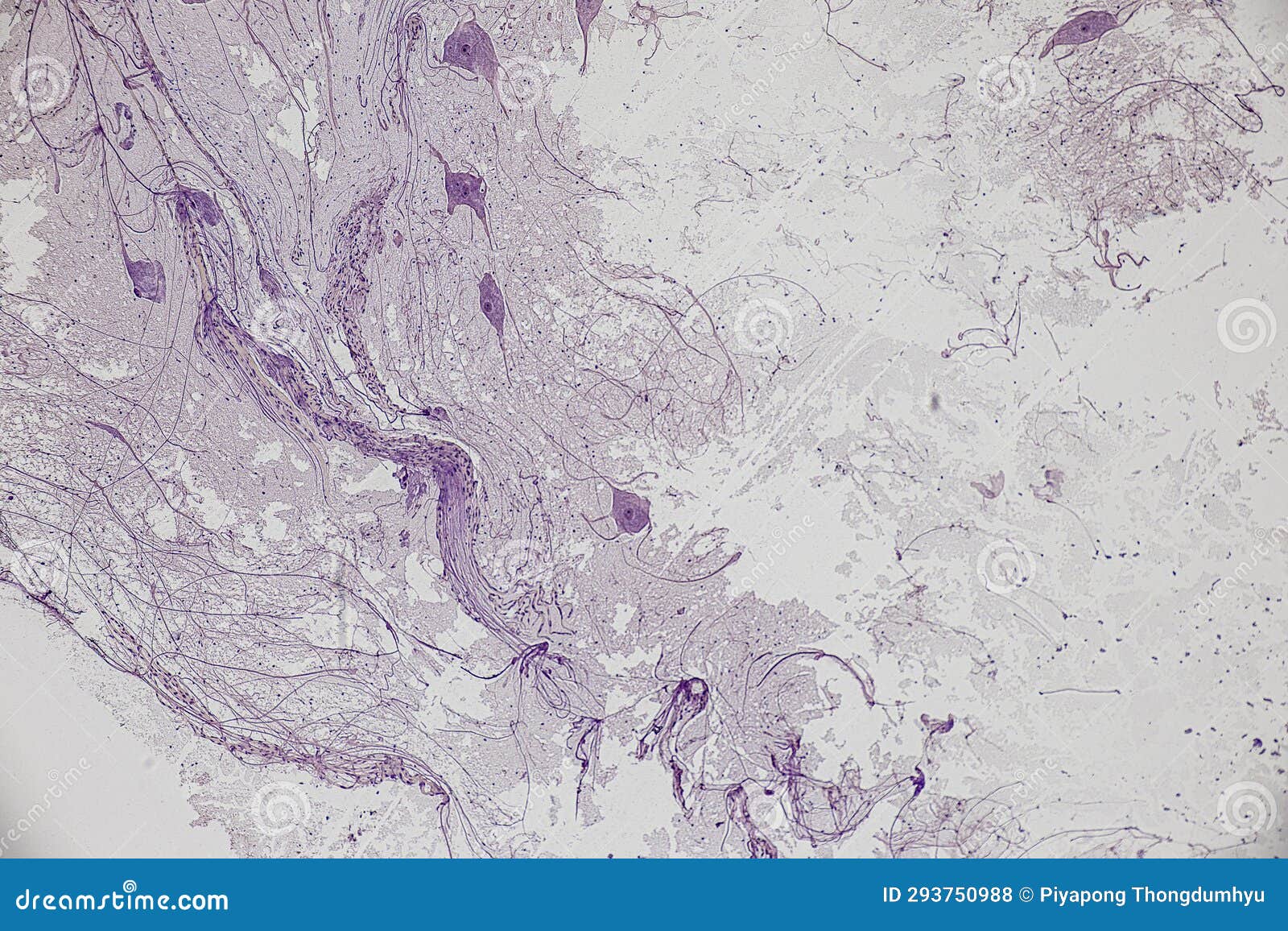 Motor Neuron, Spinal Cord, Nerve Fibres and Nerve Cells Under the ...