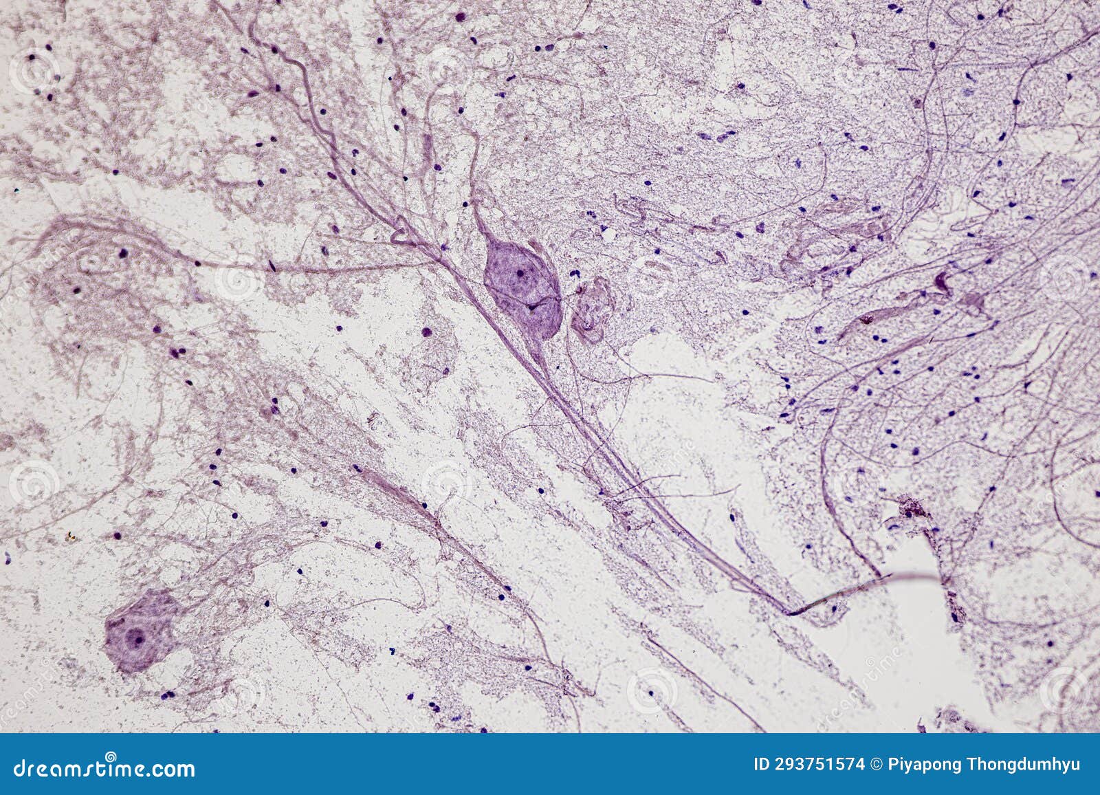 Motor Neuron, Spinal Cord, Nerve Fibres and Nerve Cells Under the ...