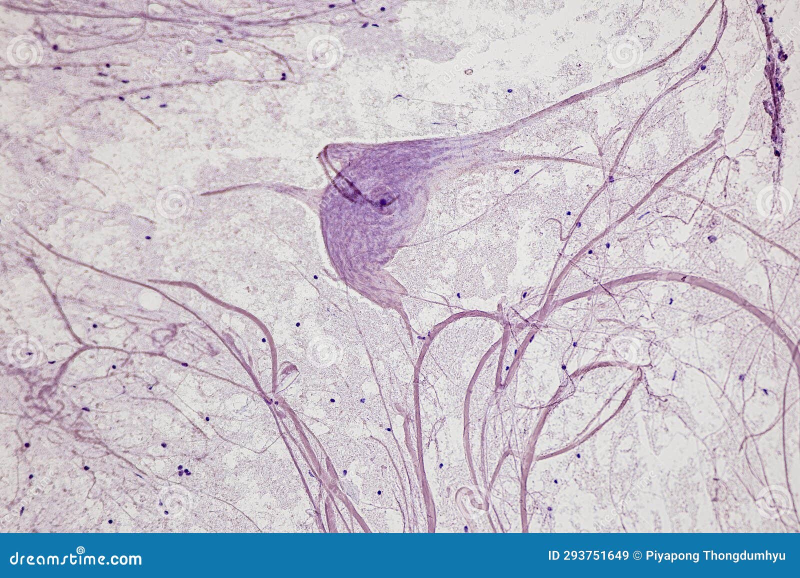 Motor Neuron, Spinal Cord, Nerve Fibres And Nerve Cells Under The ...