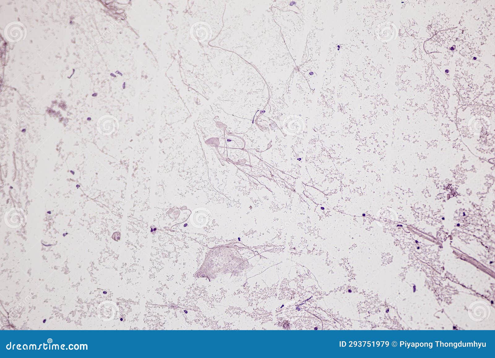 Motor Neuron, Spinal Cord, Nerve Fibres and Nerve Cells Under the ...