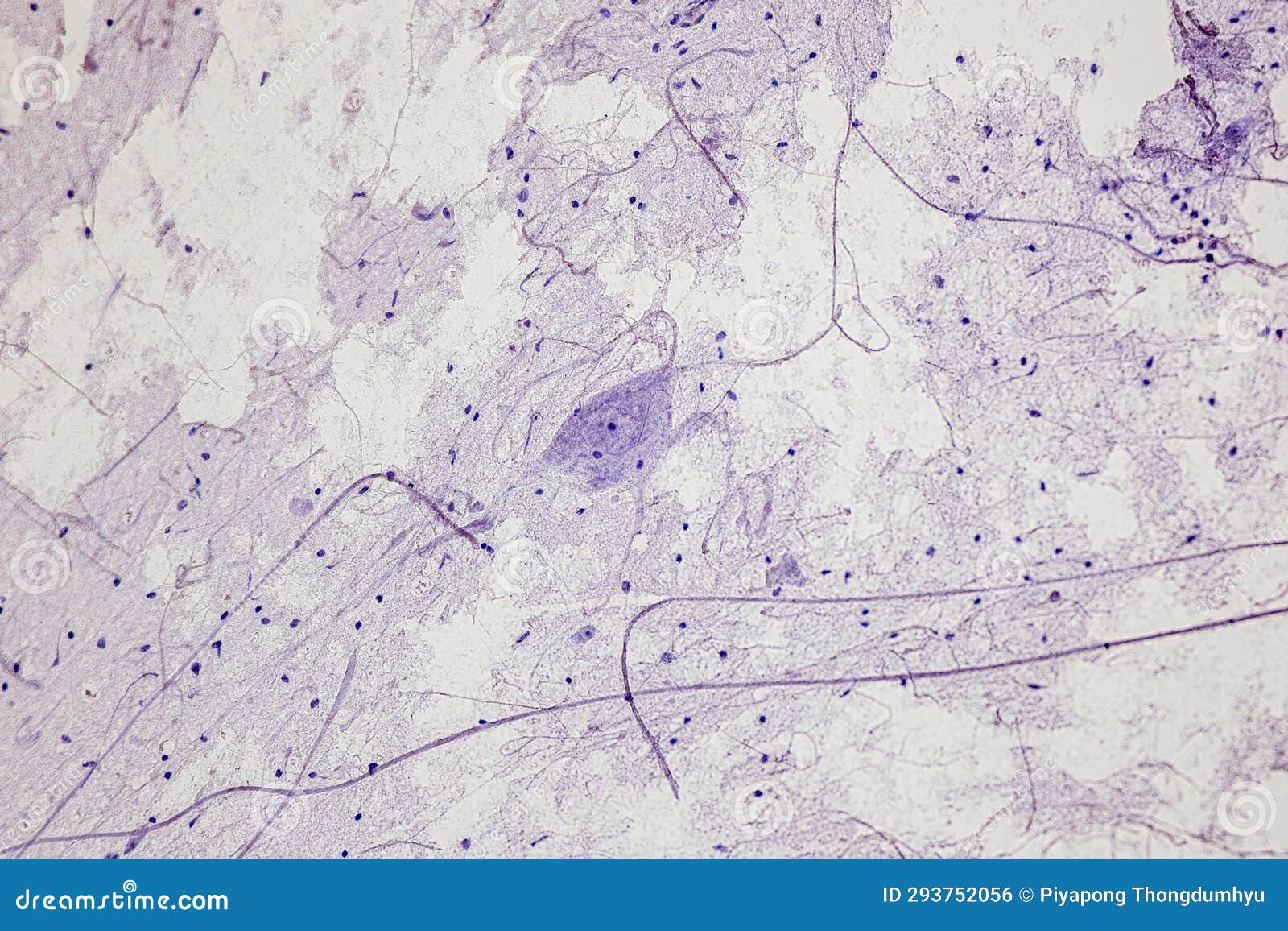 Motor Neuron, Spinal Cord, Nerve Fibres and Nerve Cells Under the ...