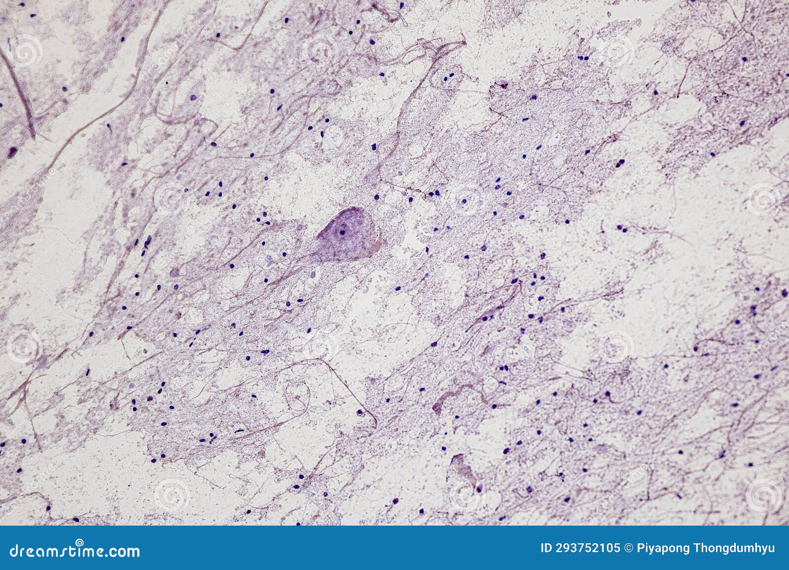 Motor Neuron, Spinal Cord, Nerve Fibres and Nerve Cells Under the ...
