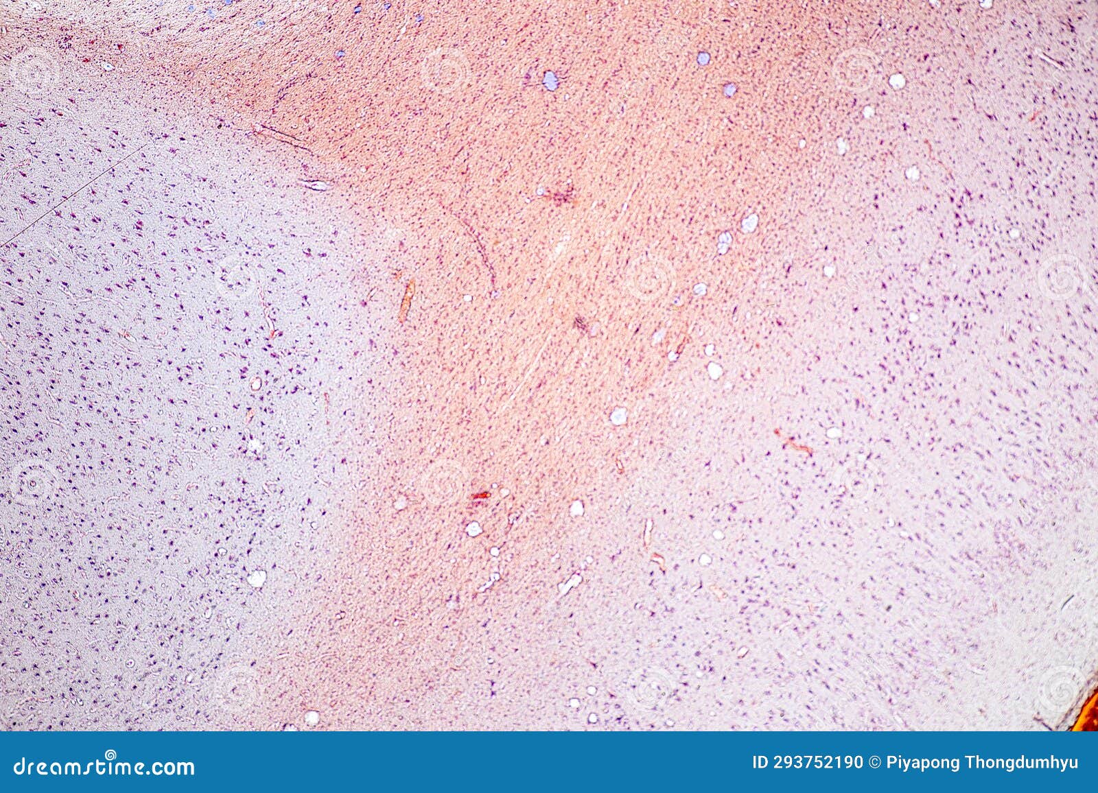 Motor Neuron, Spinal Cord, Nerve Fibres and Nerve Cells Under the ...