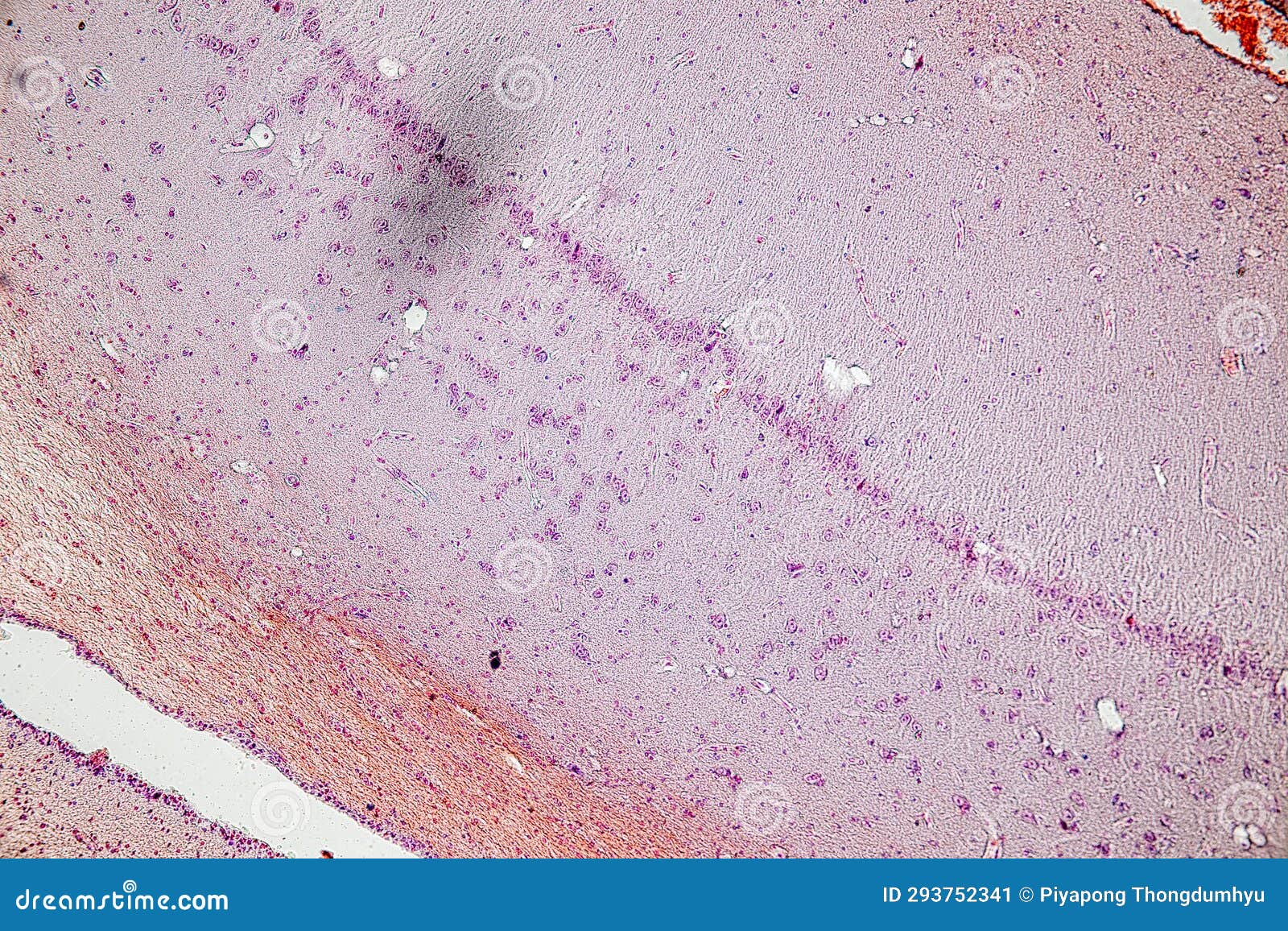 Motor Neuron, Spinal Cord, Nerve Fibres and Nerve Cells Under the ...