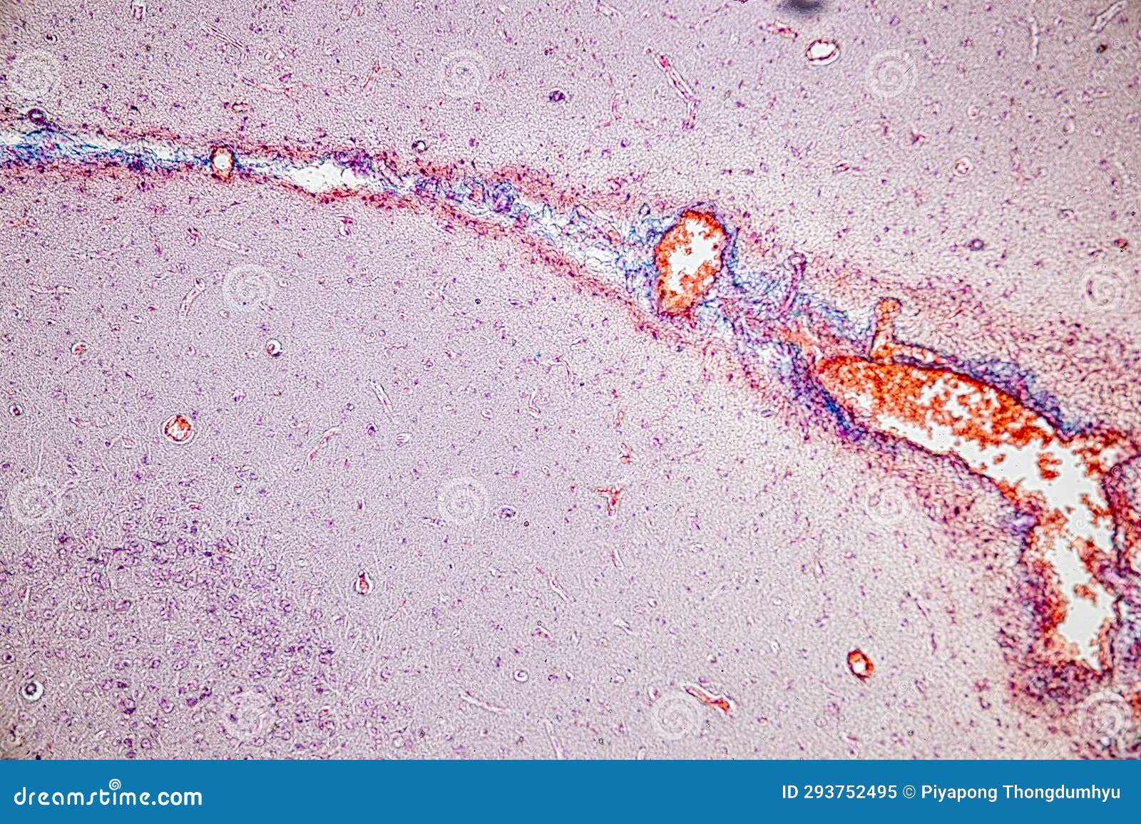 Motor Neuron, Spinal Cord, Nerve Fibres and Nerve Cells Under the ...