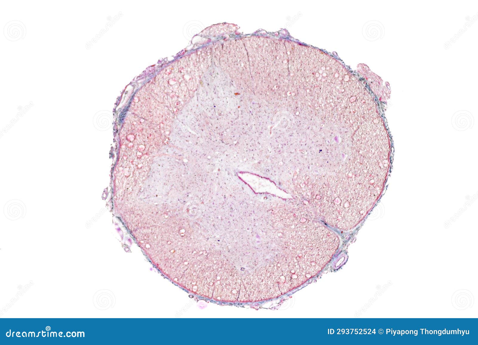 Motor Neuron, Spinal Cord, Nerve Fibres and Nerve Cells Under the ...