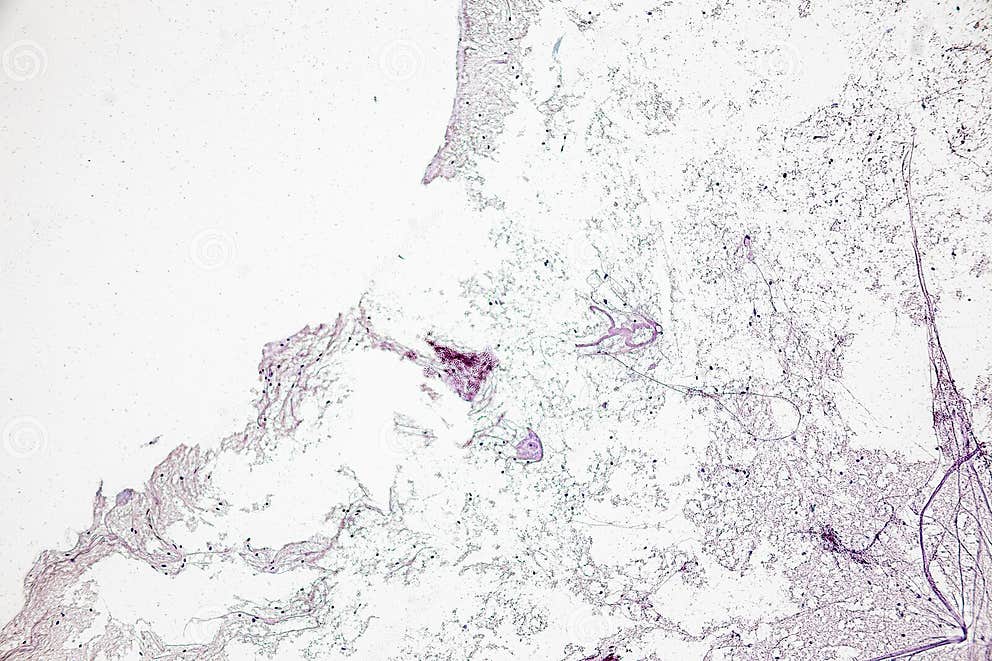 Motor Neuron, Spinal Cord, Nerve Fibres and Nerve Cells Under the ... Motor Neuron, Spinal Cord, Nerve Fibres and Nerve Cells Under the ...