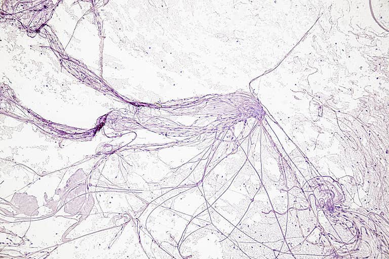 Motor Neuron, Spinal Cord, Nerve Fibres and Nerve Cells Under the ... Motor Neuron, Spinal Cord, Nerve Fibres and Nerve Cells Under the ...