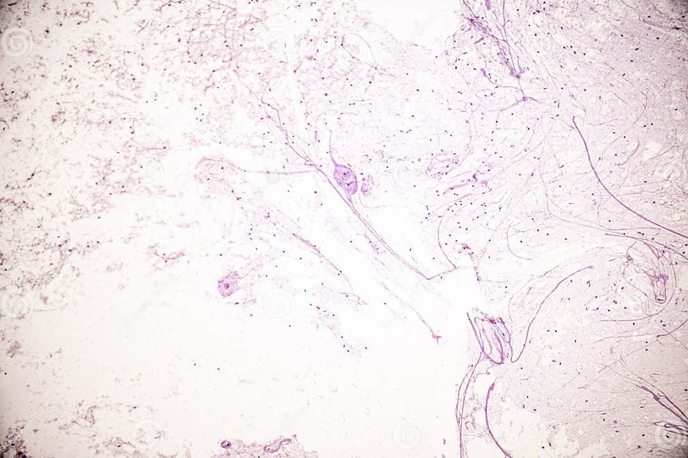 Motor Neuron, Spinal Cord, Nerve Fibres and Nerve Cells Under the ... Motor Neuron, Spinal Cord, Nerve Fibres and Nerve Cells Under the ...