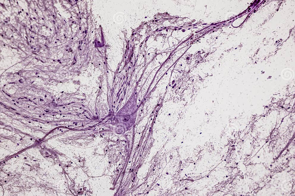 Motor Neuron, Spinal Cord, Nerve Fibres and Nerve Cells Under the ... Motor Neuron, Spinal Cord, Nerve Fibres and Nerve Cells Under the ...
