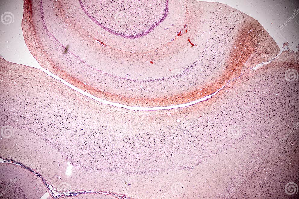 Motor Neuron, Spinal Cord, Nerve Fibres and Nerve Cells Under the ... Motor Neuron, Spinal Cord, Nerve Fibres and Nerve Cells Under the ...