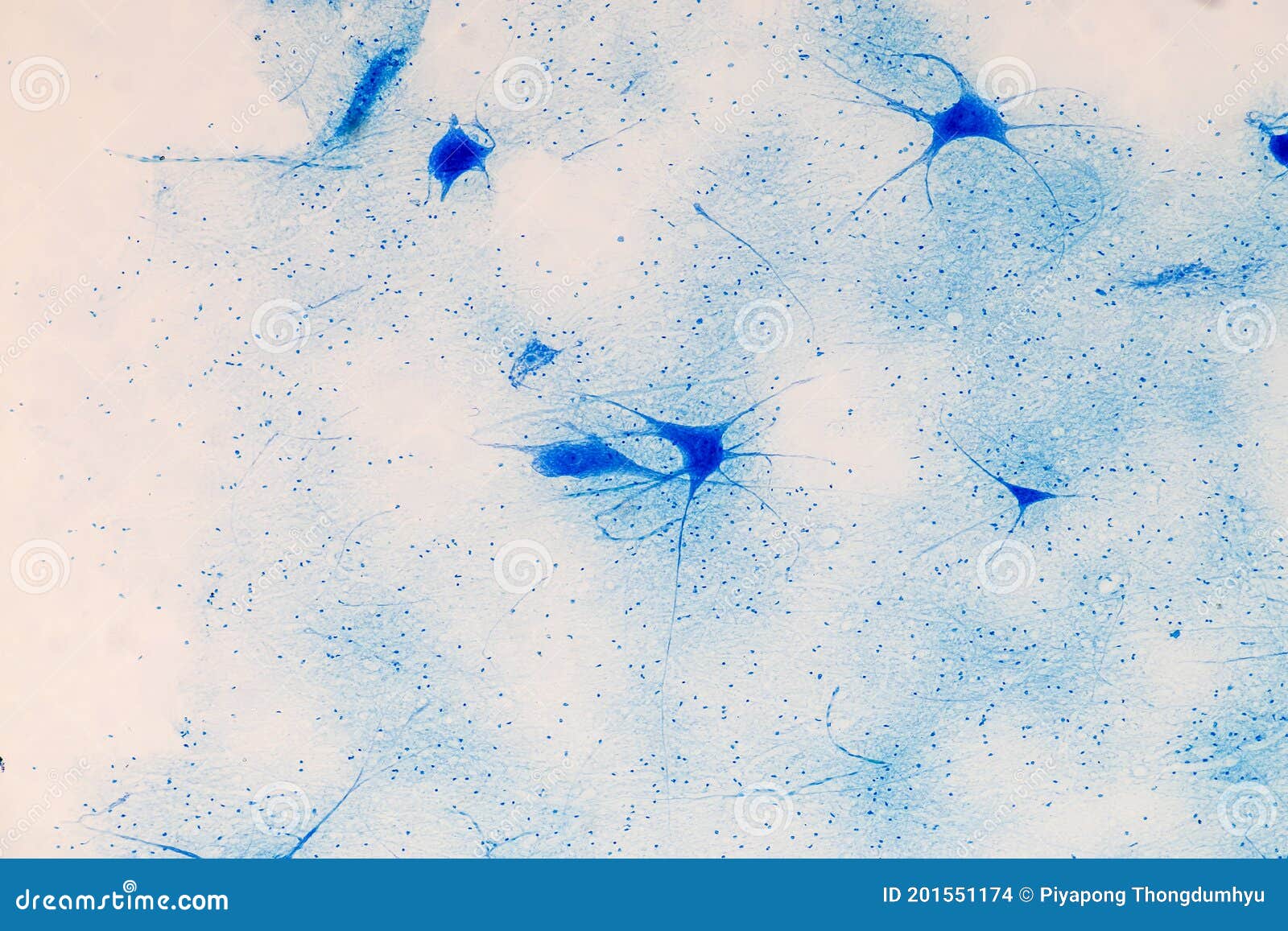 Motor Neuron Under the Microscope. Stock Photo - Image of microscope ...