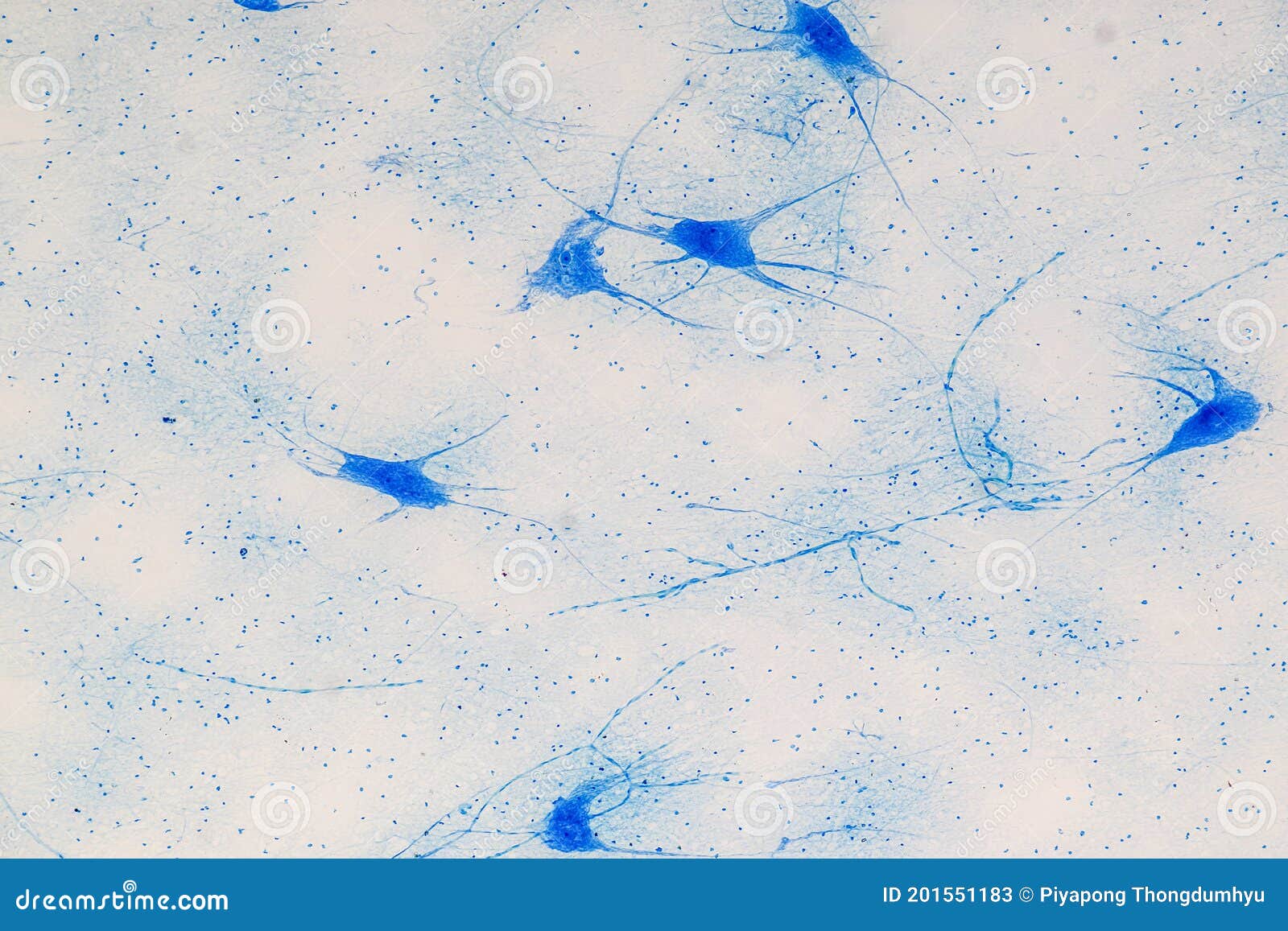 Motor Neuron Under the Microscope. Stock Image - Image of eosin ...