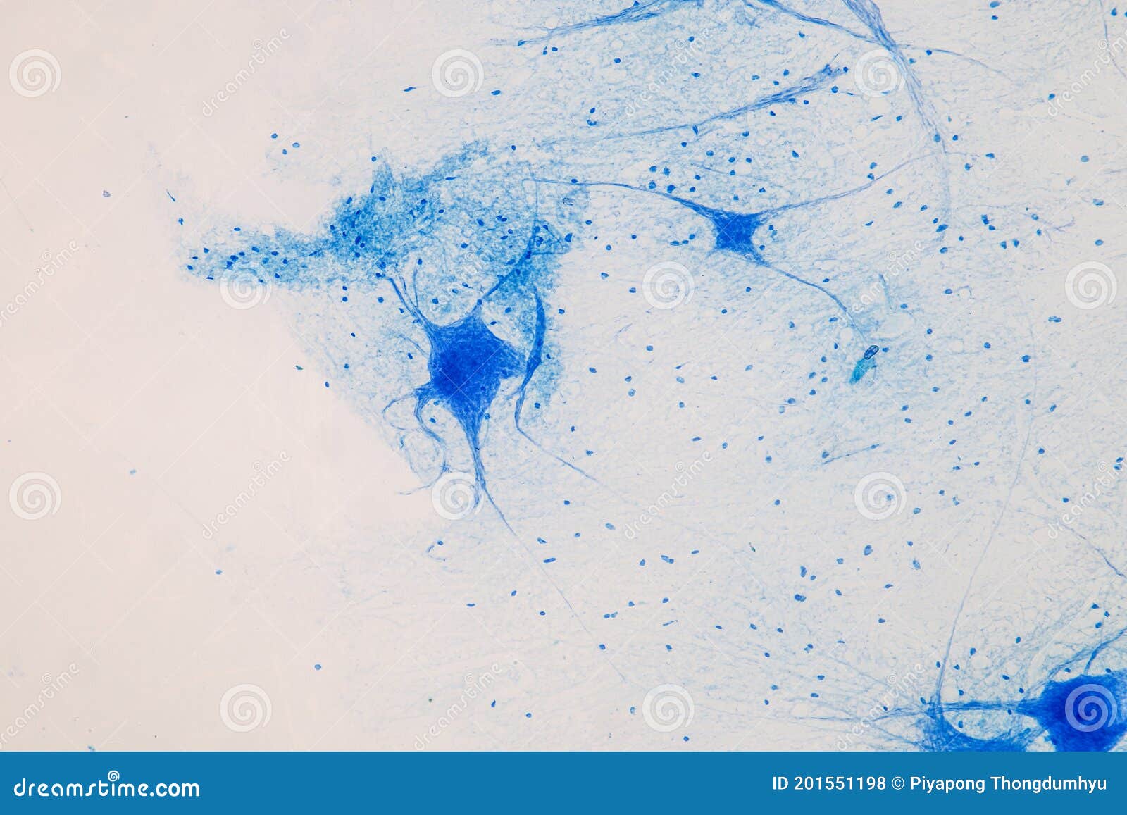 Motor Neuron Under the Microscope. Stock Photo - Image of histological ...