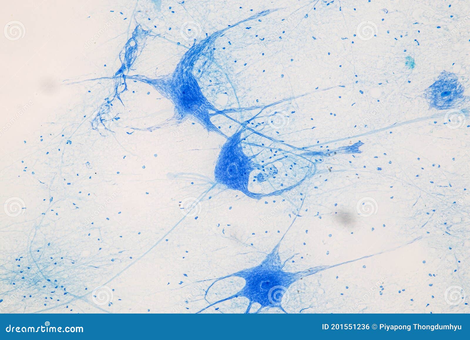 Motor Neuron And Nerve Cells Under The Microscope. Royalty-Free Stock ...