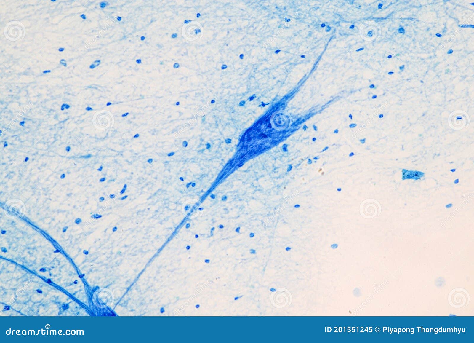 Motor Neuron Under the Microscope. Stock Image - Image of histological ...