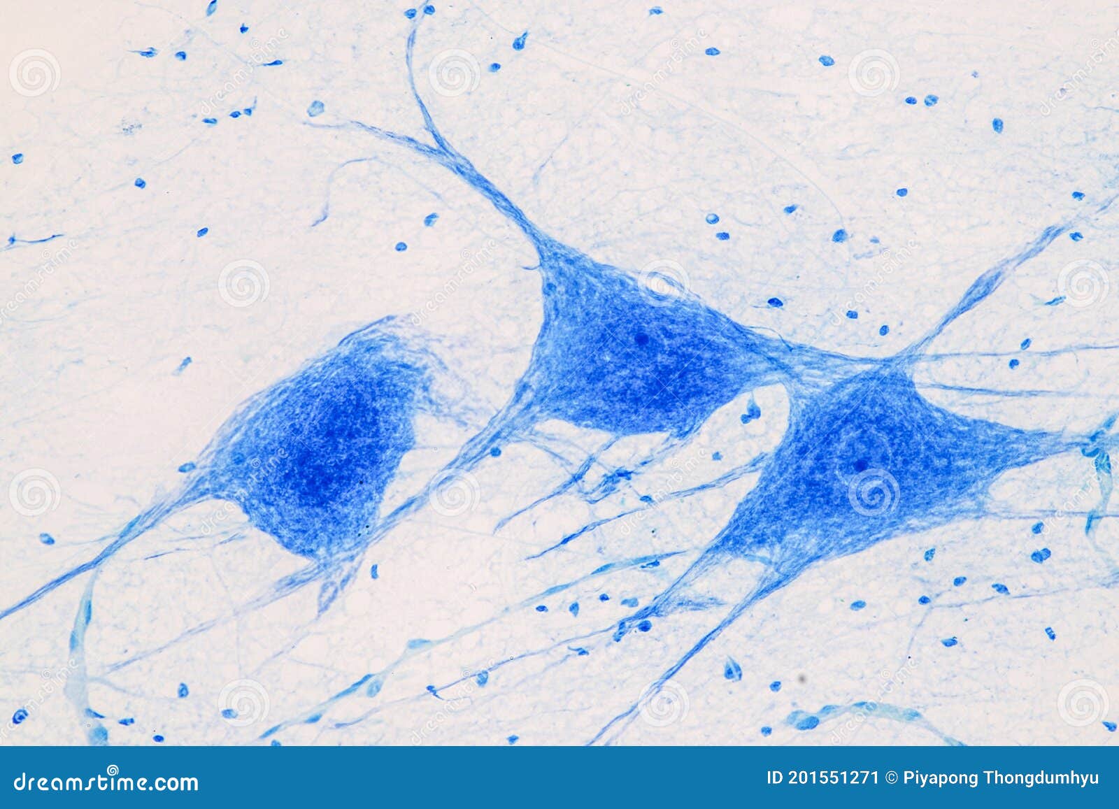 Motor Neuron Under the Microscope. Stock Image - Image of histology ...