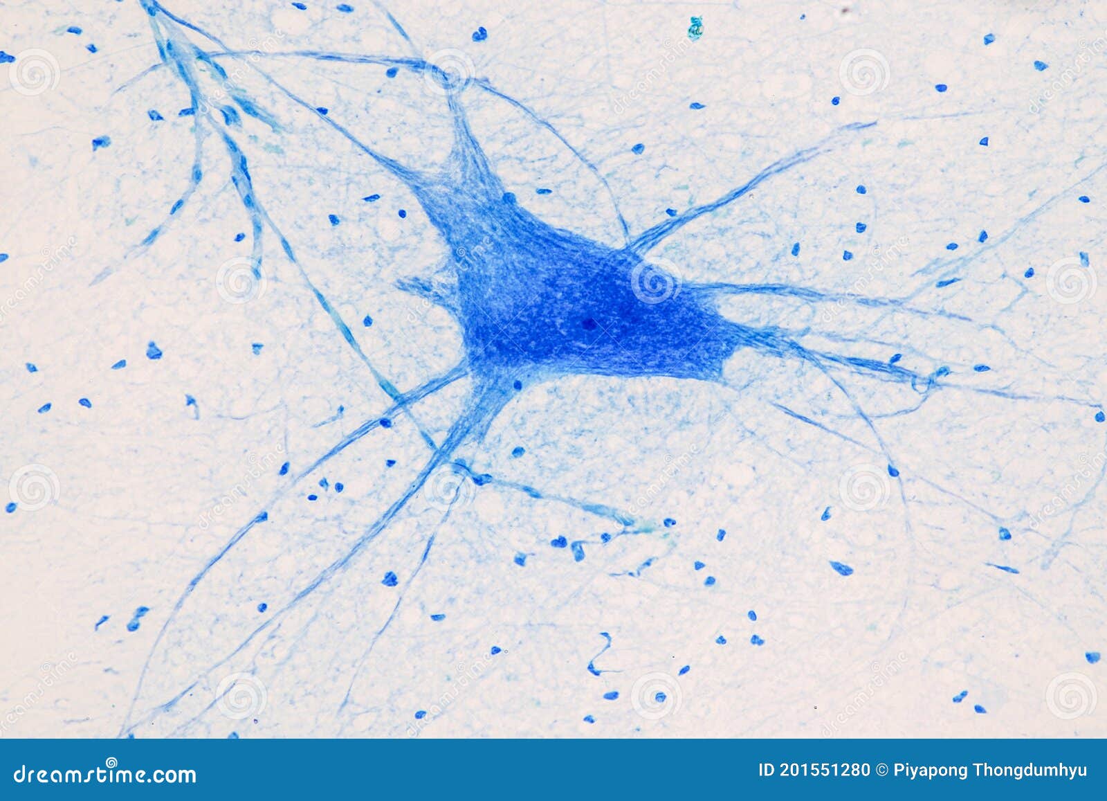 Motor Neuron Under the Microscope. Stock Photo - Image of microscopical ...
