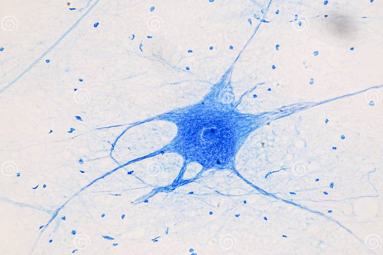Motor Neuron Under the Microscope. Stock Image - Image of light ...