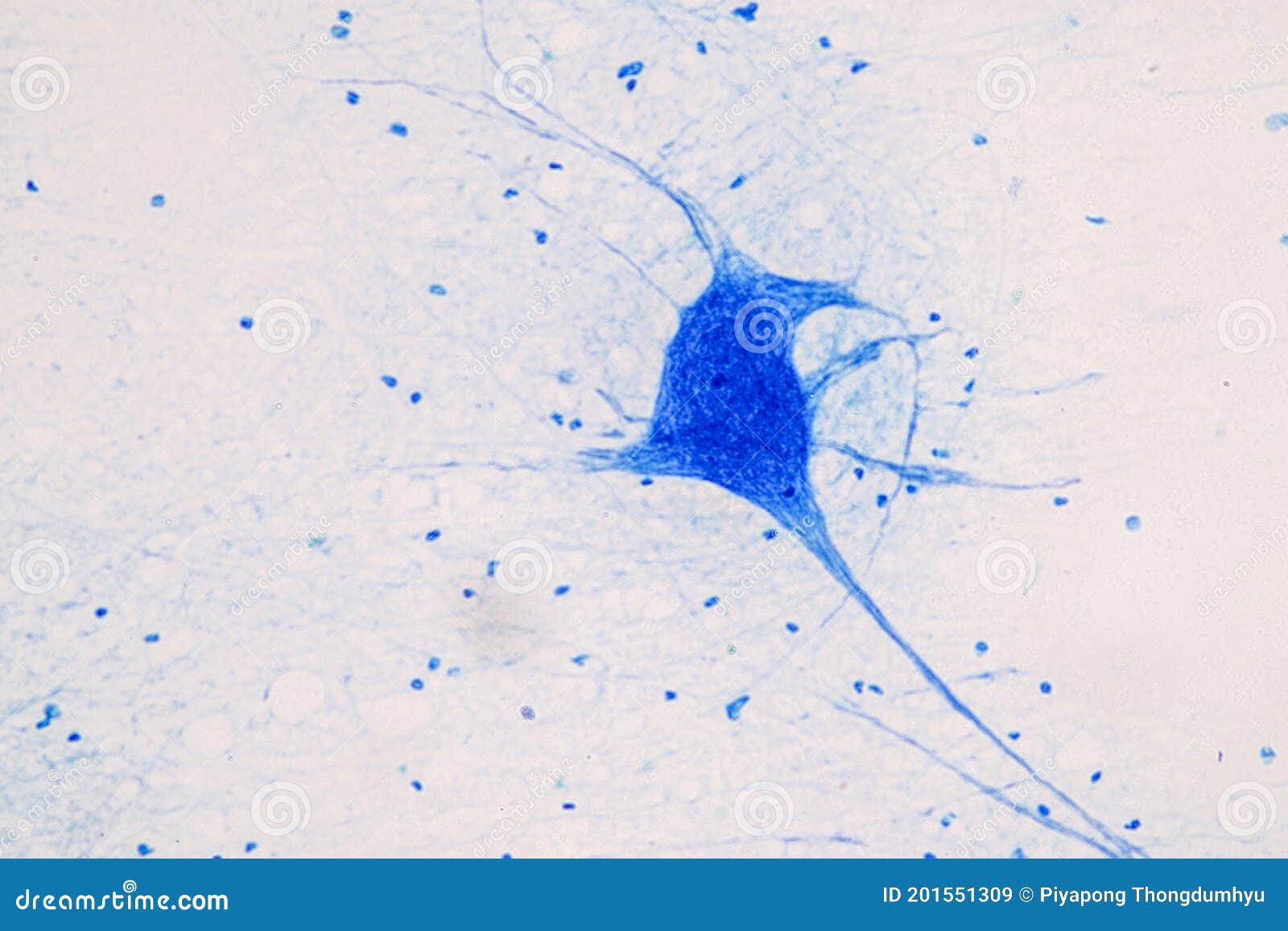 Motor Neuron Under the Microscope. Stock Image - Image of microscopic ...