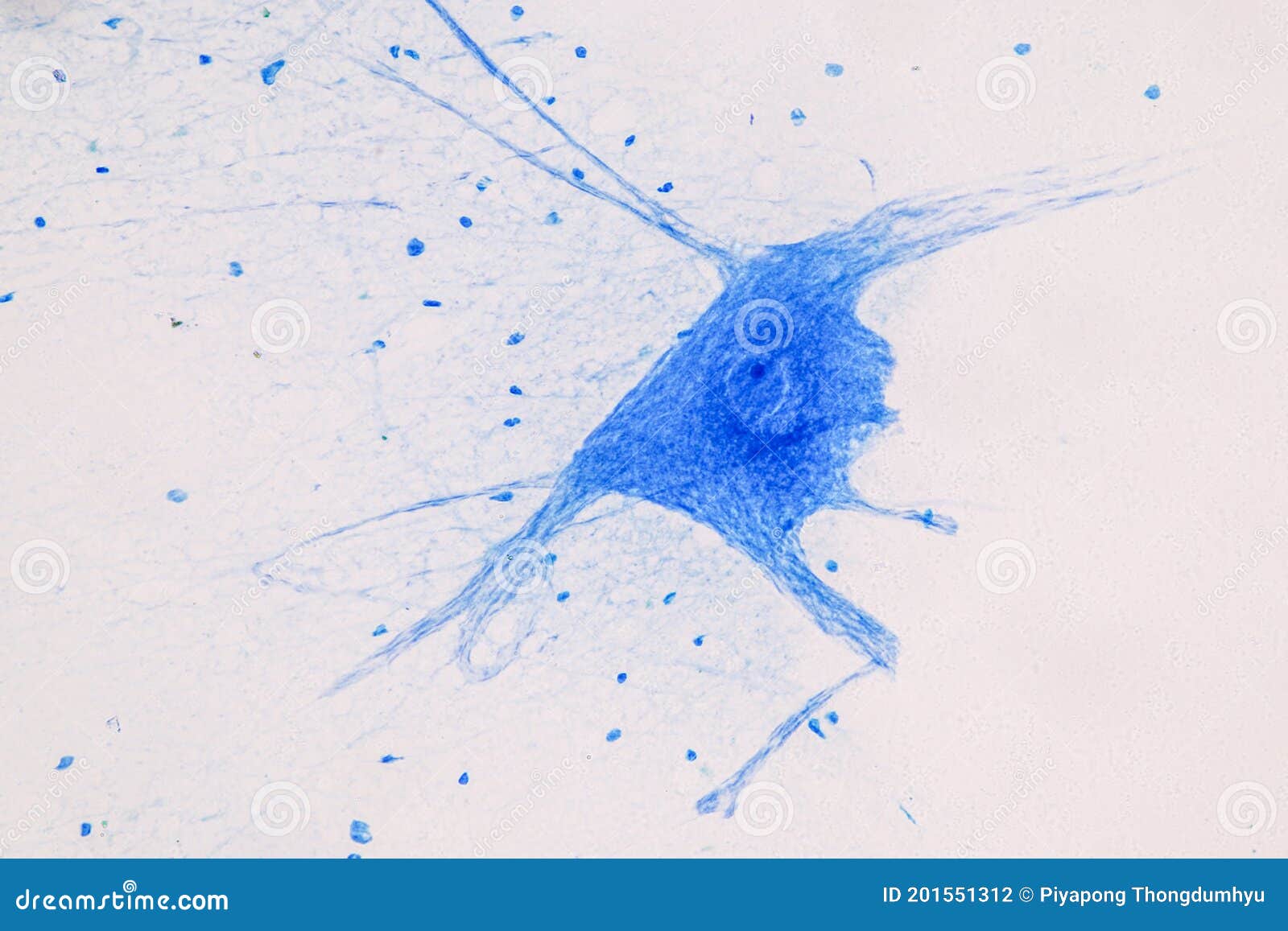 Motor Neuron Under the Microscope. Stock Photo - Image of microscopy ...