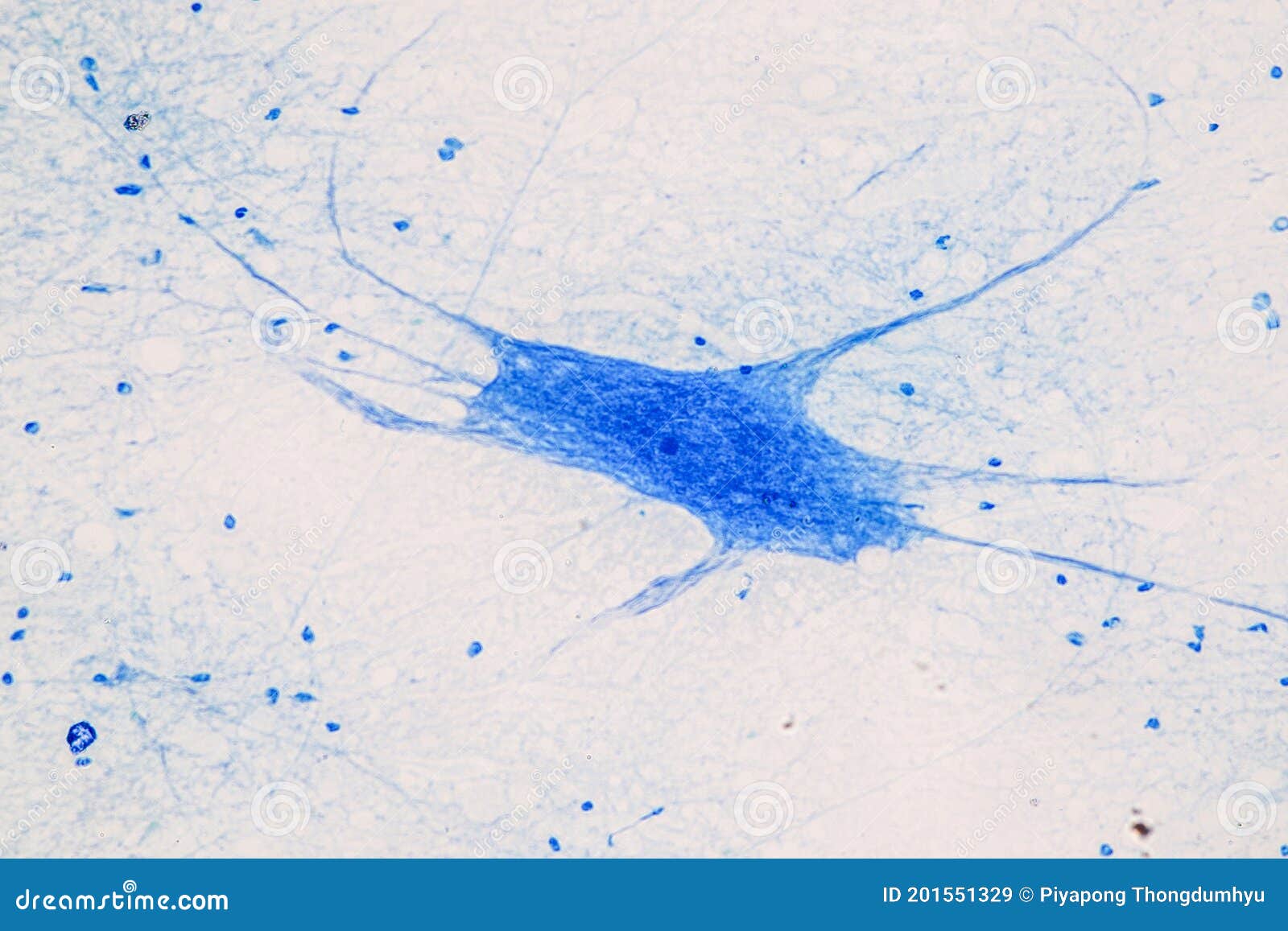 Motor Neuron Under the Microscope. Stock Image - Image of histology ...