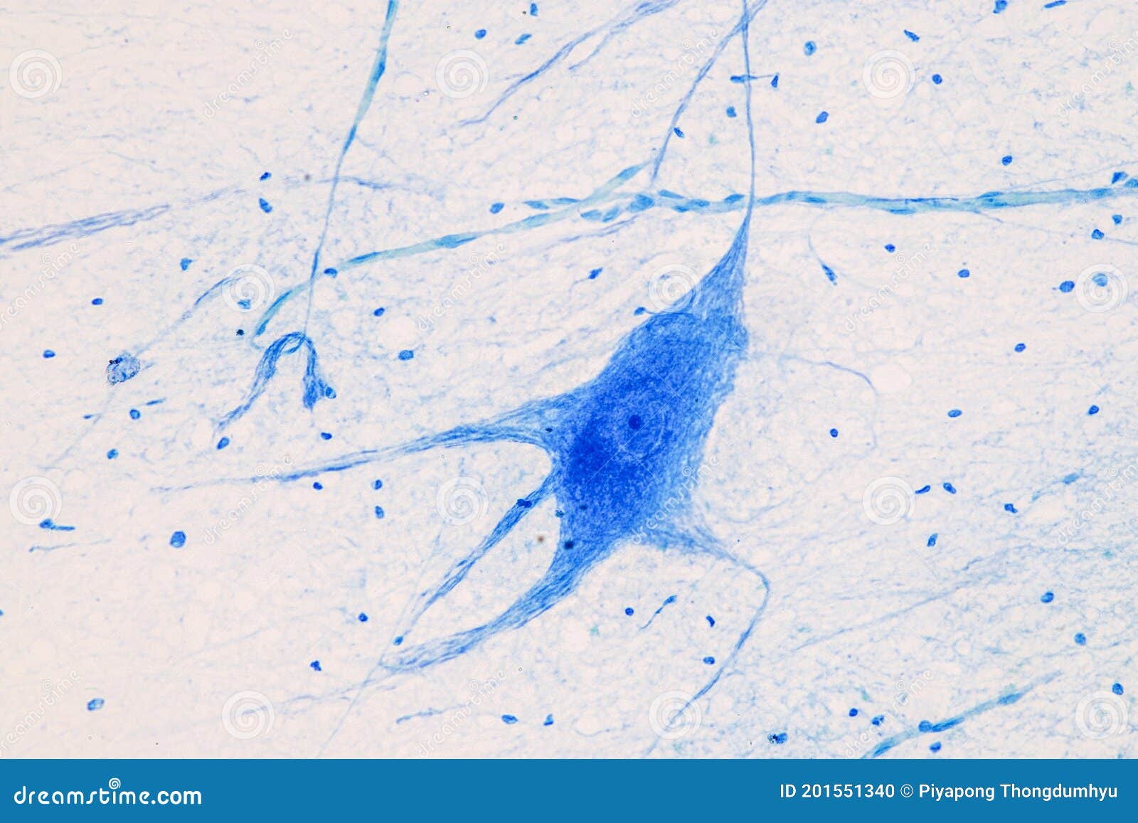 Motor Neuron Under the Microscope. Stock Photo - Image of magnification ...