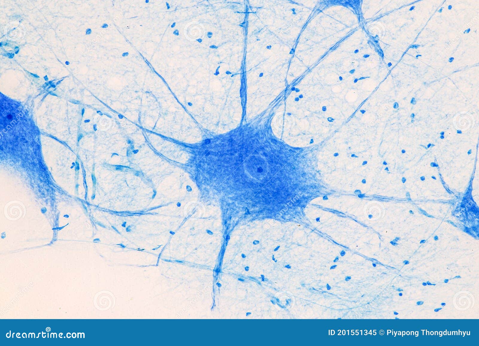 Motor Neuron Under the Microscope. Stock Image - Image of horn ...