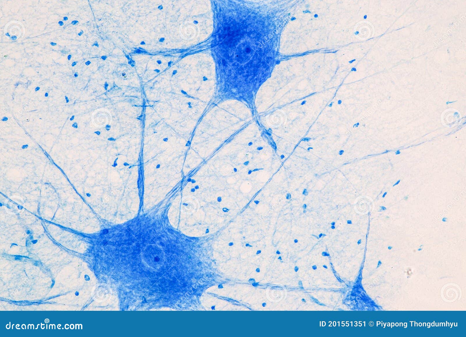 Motor Neuron Slide Labeled